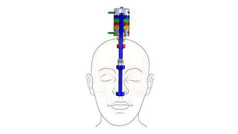 Surgical Navigation Using Patient Registration Methods Masuration