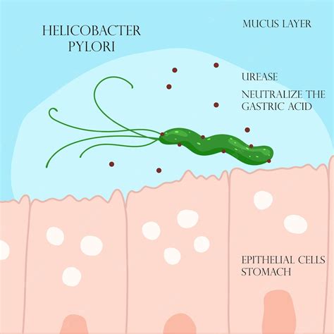 위 인포그래픽의 점막층에 있는 헬리코박터 파일로리 프리미엄 벡터