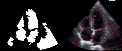 Opencv 拼接缝 Opencv粘连分割棉花糖的技术博客51cto博客 Opencv 拼接缝 Opencv粘连分割棉花糖的技术博客51cto博客