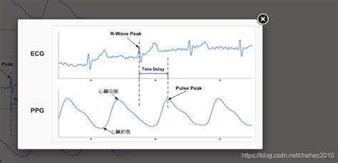 Ecgppg量测解决方案ecg Ppg 方案 Csdn博客 Ecgppg量测解决方案ecg Ppg 方案 Csdn博客