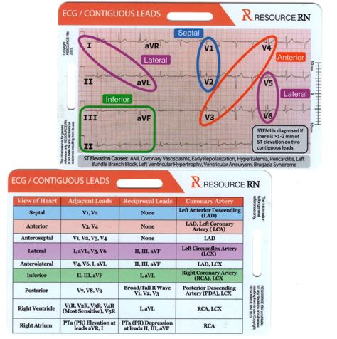 Ekg Pocket Card Double Sided Ekg Interpretation Badge Card Ecg
