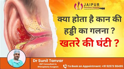 क्या होता है कान की हड्डी का गलना सर्जरी करवाना क्यों है जरुरी Mastoidectomy हड्डी का सड़ना
