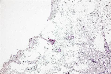 Motor Neuron Spinal Cord Nerve Fibres And Nerve Cells Under The