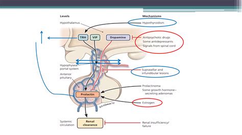 Hyperprolactinemia Case Presentation Pptx