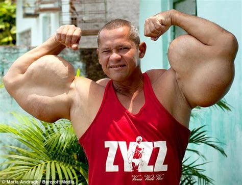 27 Synthol Transformations So Extreme You Wont Believe Theyre Real