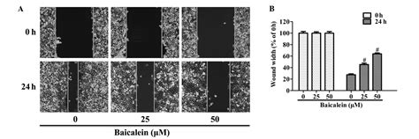 Baicalein Inhibits Migration And Invasion Of Gastric Cancer Cells Through Suppression Of The TGF