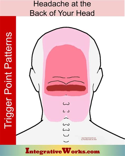 Headache Spots Headache Types Location Relief And Treatment Gwkx