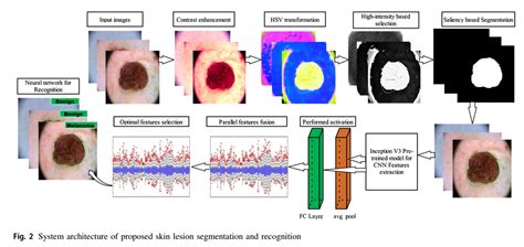 Skin Lesion Detection And Recognition In Matlab File Exchange MATLAB Central