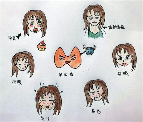 甲状腺功能亢进症的营养治疗原则有哪些 涉县中医院