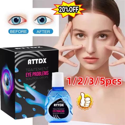 1 5pcs Treatment Eyeproblems Solutiondrops Eye Drops For Dry Eyes к δ с μθ 547 Picclick Au