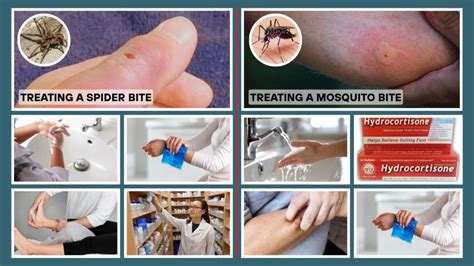 Spider Bite Vs Mosquito Bite How To Tell The Difference