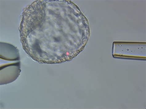 Ahmad Awartani On Linkedin Trophectoderm Biopsy For A Fully Hatched Embryo Using Flicking