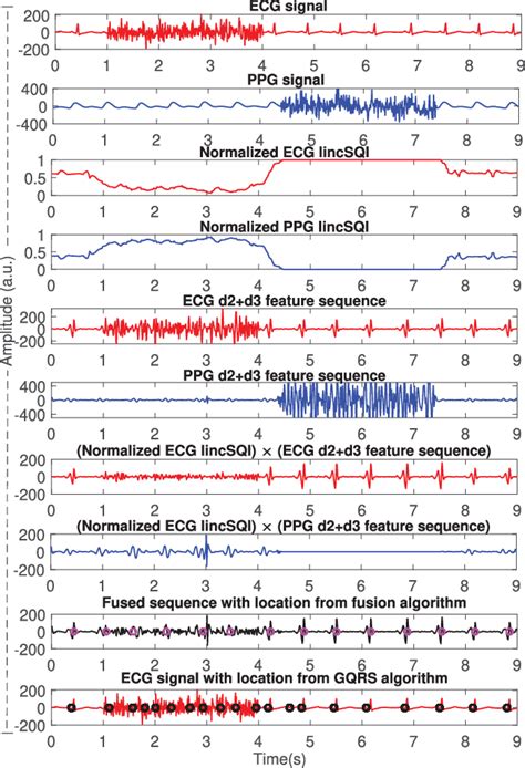 Figure 4 From A Multimodal Data Fusion Technique For Heartbeat