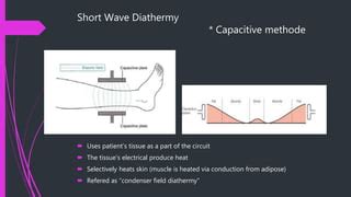Short Wave Diathermy Ppt