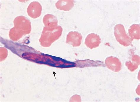 纤维细胞 实验诊断学图谱