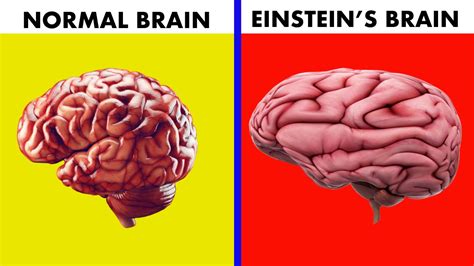 Einstein Brain