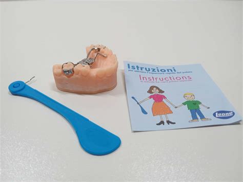 Rapid Maxillary Expander Rmerpe Absolute Dental Laboratory