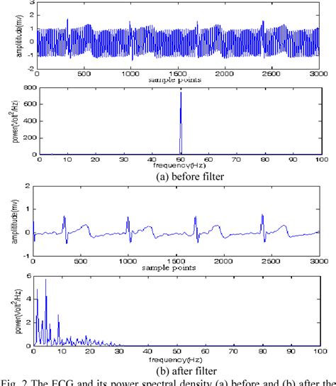 figure 2 from comparison of median filter and discrete dyadic wavelet