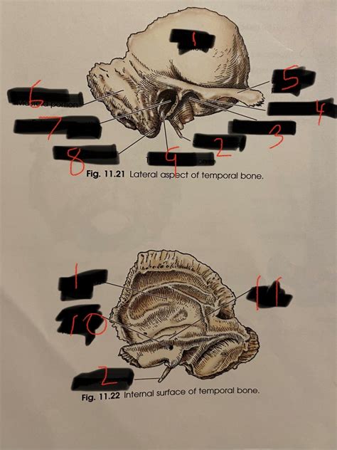 Temporal Bone Lateral Internal Diagram Quizlet