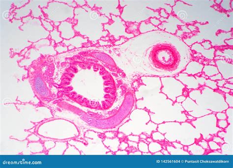 Lung Microscope Slide Labeled At Penny Troche Blog