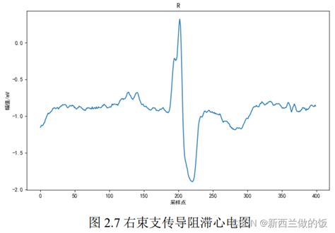 基于深度学习的心律异常分类算法 心率不齐检测系统基于硬件环境的开发代码 csdn博客