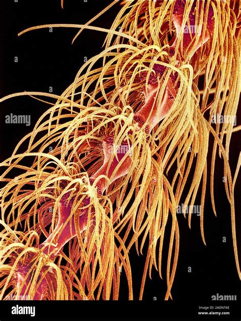 Moth Fly Antenna Coloured Scanning Electron Micrograph Sem Of The