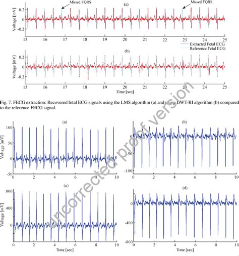 Daisy Database Abdomen2 A And Abdomen5 B As Examples Of The Download Scientific Diagram