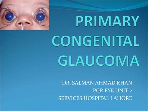 Primary Congenital Glaucomappt