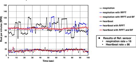 Figure 1 From Non Contact Vital Signs Monitoring Of A Patient Lying On Surgical Bed Using