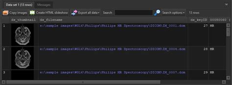 Converting Dicom Images To Png Tif Jpeg Yohz Software Development Blog
