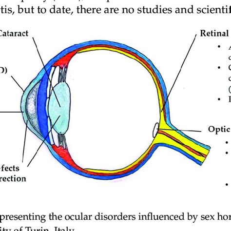 Drawing Presenting The Ocular Disorders Influenced By Sex Hormones