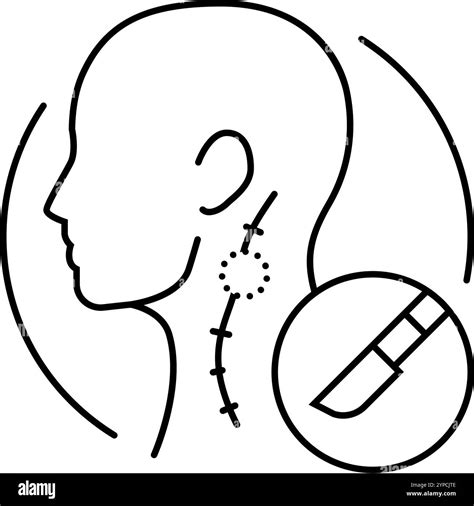 Lymph Node Dissection Surgery Line Icon Vector Illustration Stock