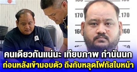 คนเดียวกันแน่นะ เทียบภาพ กำนันนก ก่อนหลังเข้ามอบตัว ถึงกับหลุดโฟกัสใบหน้า สยามนิวส์ Line Today