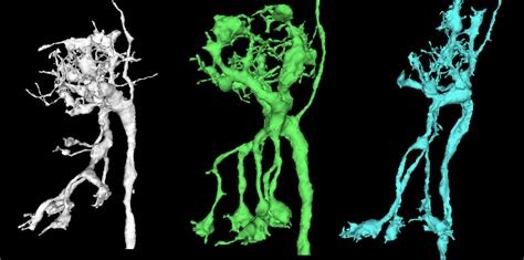Useful Structural Patterns In The Optic Lobe Inferring Microstructure From Macrostructure