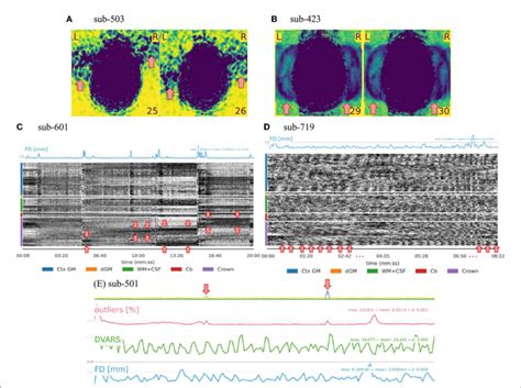 FIGURE QA QC Of MRI Data Relies Substantially On The Background Download Scientific Diagram