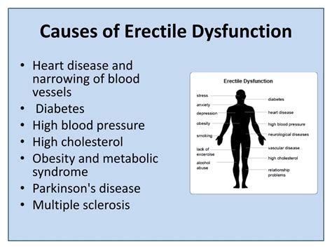 PPT Achieve Powerful Erections With Hard Rock Capsule PowerPoint Presentation ID 12066129