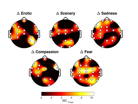 Scalp Map Showing The Topographical Distribution Of The Significant