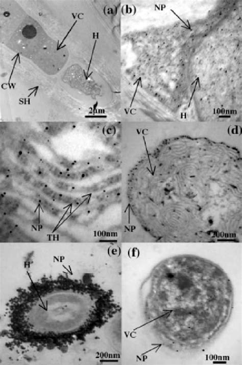 Tem Micrographs Of Cyanobacteria Thin Sections A Calothrix In Sterile Download Scientific