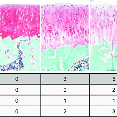 Semiquantitative Scoring System For Cox 2 Staining Download