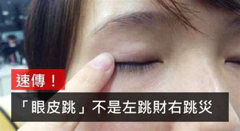 『左眼跳財、右眼跳災？』錯！原來我們都誤會了！眼皮跳其實是代表