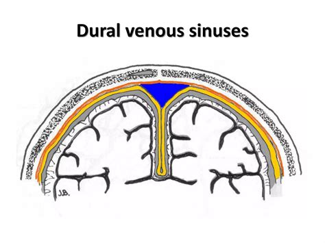 Dural Venous Sinuses Pdf Dural Venous Sinuses Pdf