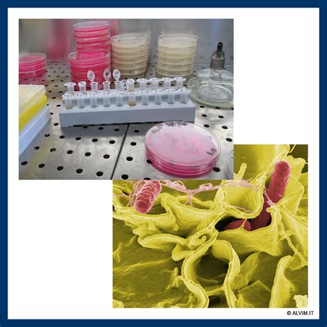 Bacterial Contamination In Food And Beverage