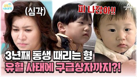 금쪽이 얼굴 흉터만 수십 개💥 상처투성이로 살아가는 연년생 형제 그 이유는💢 오은영 금쪽같은내새끼 금쪽같은 내새끼 153회 Youtube