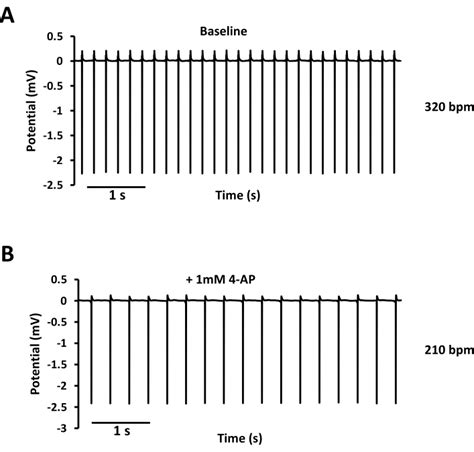 Microelectrode Array Recording Of Sinoatrial Node Firing Rate To Identify Intrinsic Cardiac