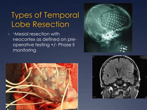 Ppt Juliann M Paolicchi Ma Md Clinical Professor Pediatrics Rutgers University Pediatric