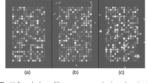 Figure 14 From Simulation Of Cdna Microarrays Via A Parameterized