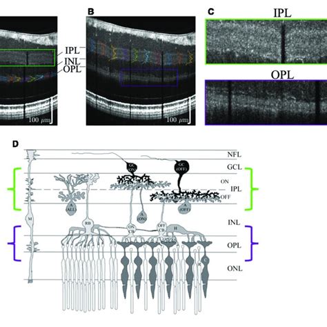 Visualization Of Outer Plexiform Layer Opl Lamination A And Inner