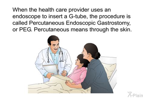 Percutaneous Endoscopic Gastrostomy Peg Pediatrics