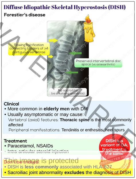 Diffuse Idiopathic Skeletal Hyperostosis Dish Medicine Keys For Mrcps