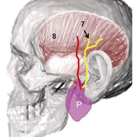 Pdf Ultrasound Guided Intervention For Treatment Of Trigeminal Neuralgia An Updated Review Of
